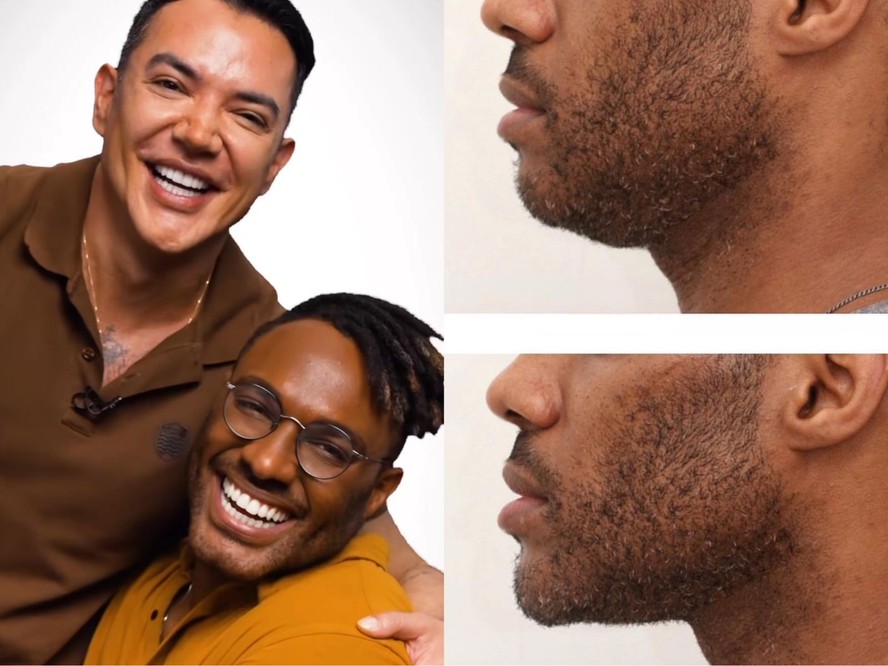 Marido de Fred Nicácio, do 'BBB' 23, mostra antes e depois dos ...