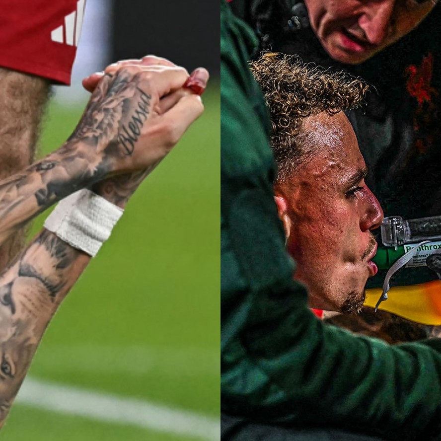 Jogador do Galatasaray sofre 'amputação parcial' de dedo da mão no ...