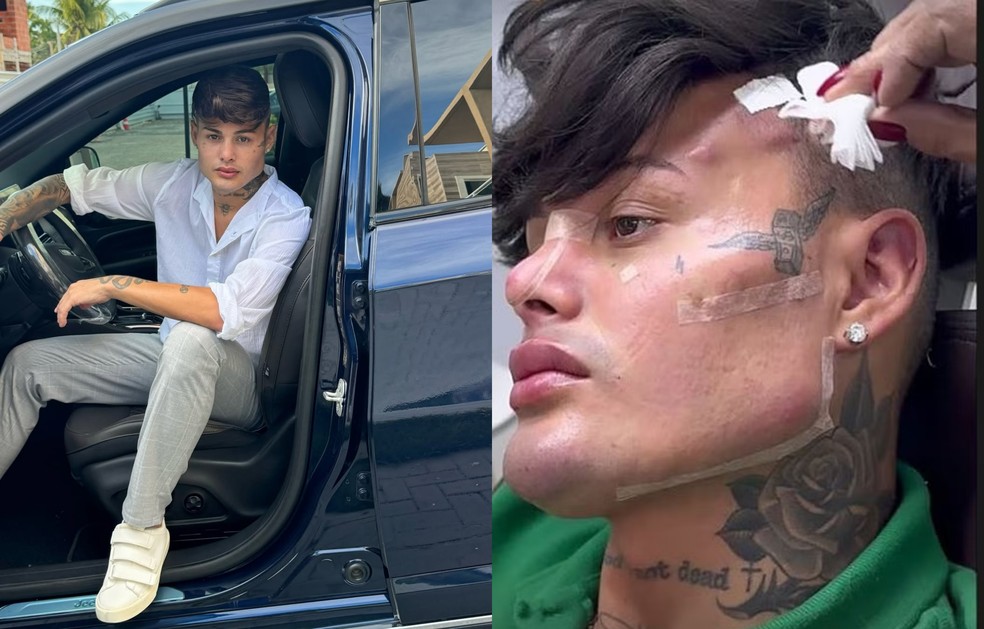 À la Cauã Reymond: influencer diz que gastou fortuna para ficar igual a galã. 'Já estou mais ou ...