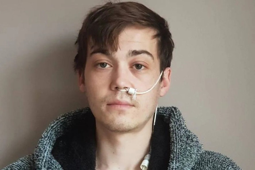 Doença rara faz homem inglês vomitar 60 vezes por dia; entenda