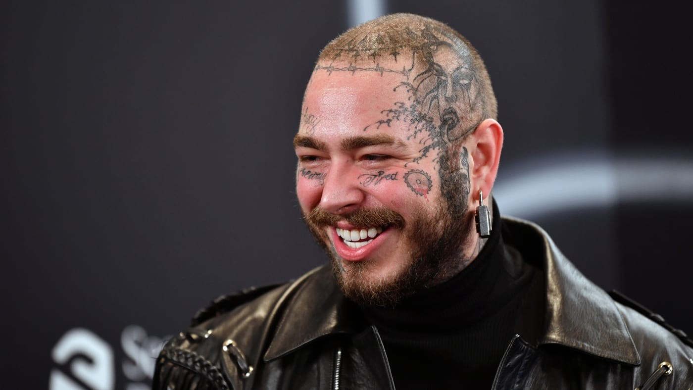Post Malone é hospitalizado devido a 'dor lancinante' uma semana após ...