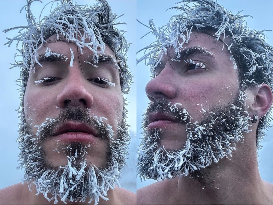 Eliezer fica com o rosto congelado no frio de -43 graus do Alasca: 'O verdadeiro nevou'