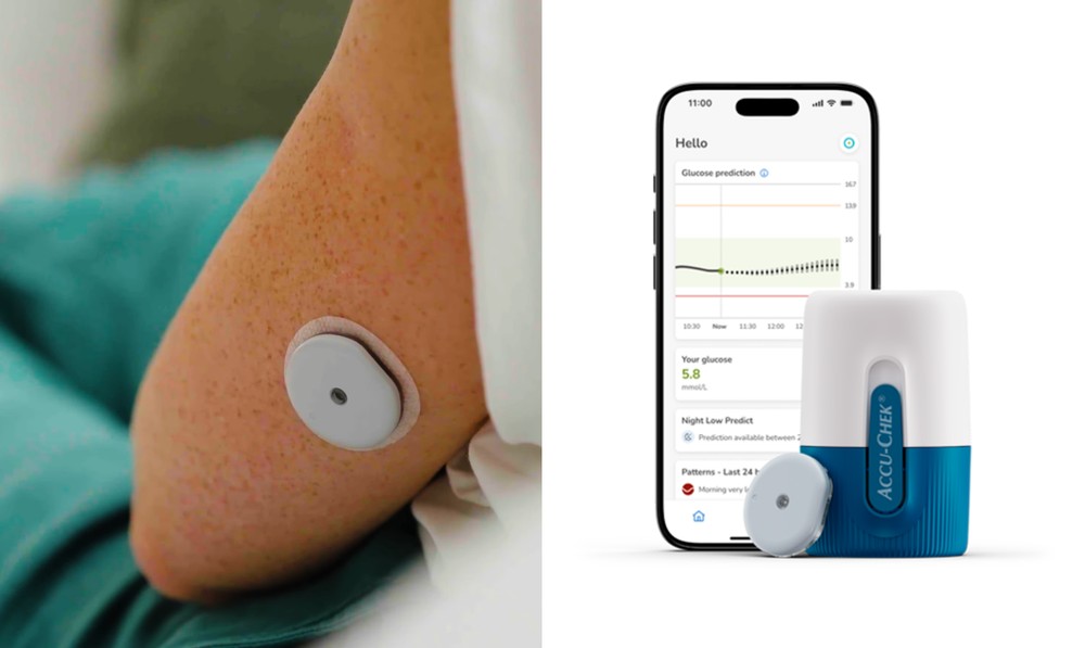 Diabetes: novo sensor com IA chega ao Brasil; veja o que faz a nova ...