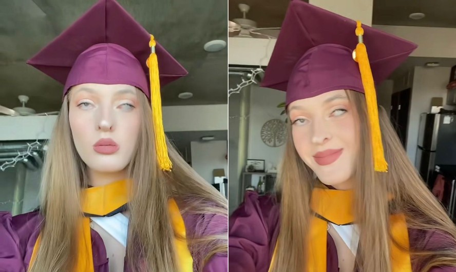 Mulher vive com condição facial rara considerada ‘uma em um milhão’