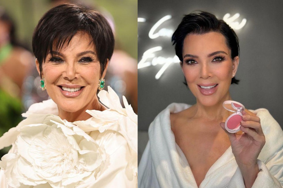 Estética 'sem make': os procedimentos que estão por trás do visual natural das celebridades