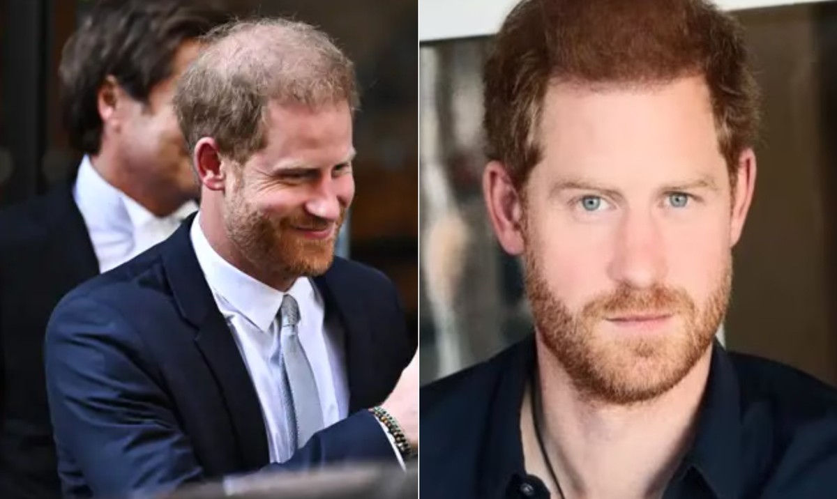 Príncipe Harry surge com cabelos mais volumosos: qual é a diferença ...