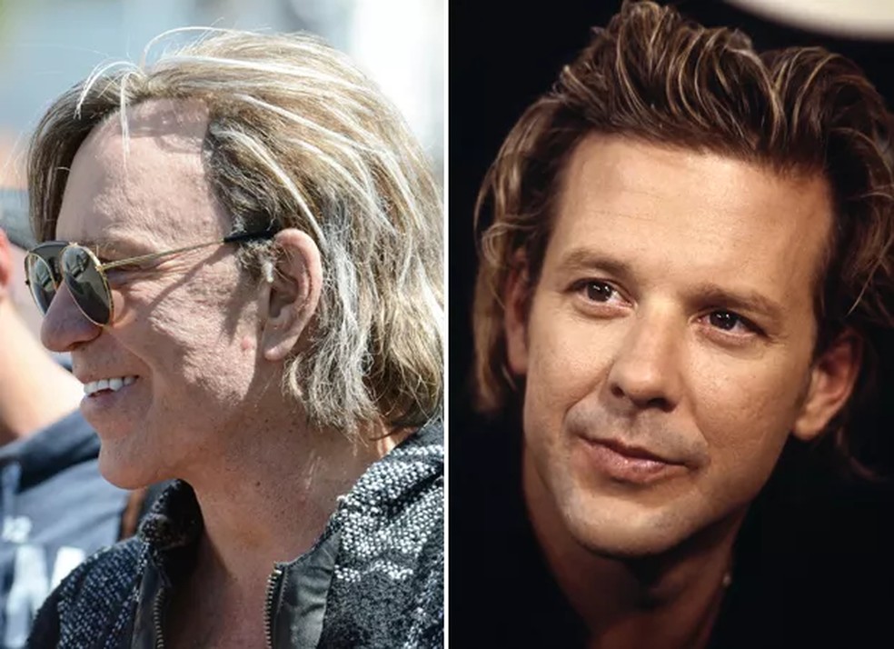 Excessos na estética: Caso de Mickey Rourke foge da tendência em ...