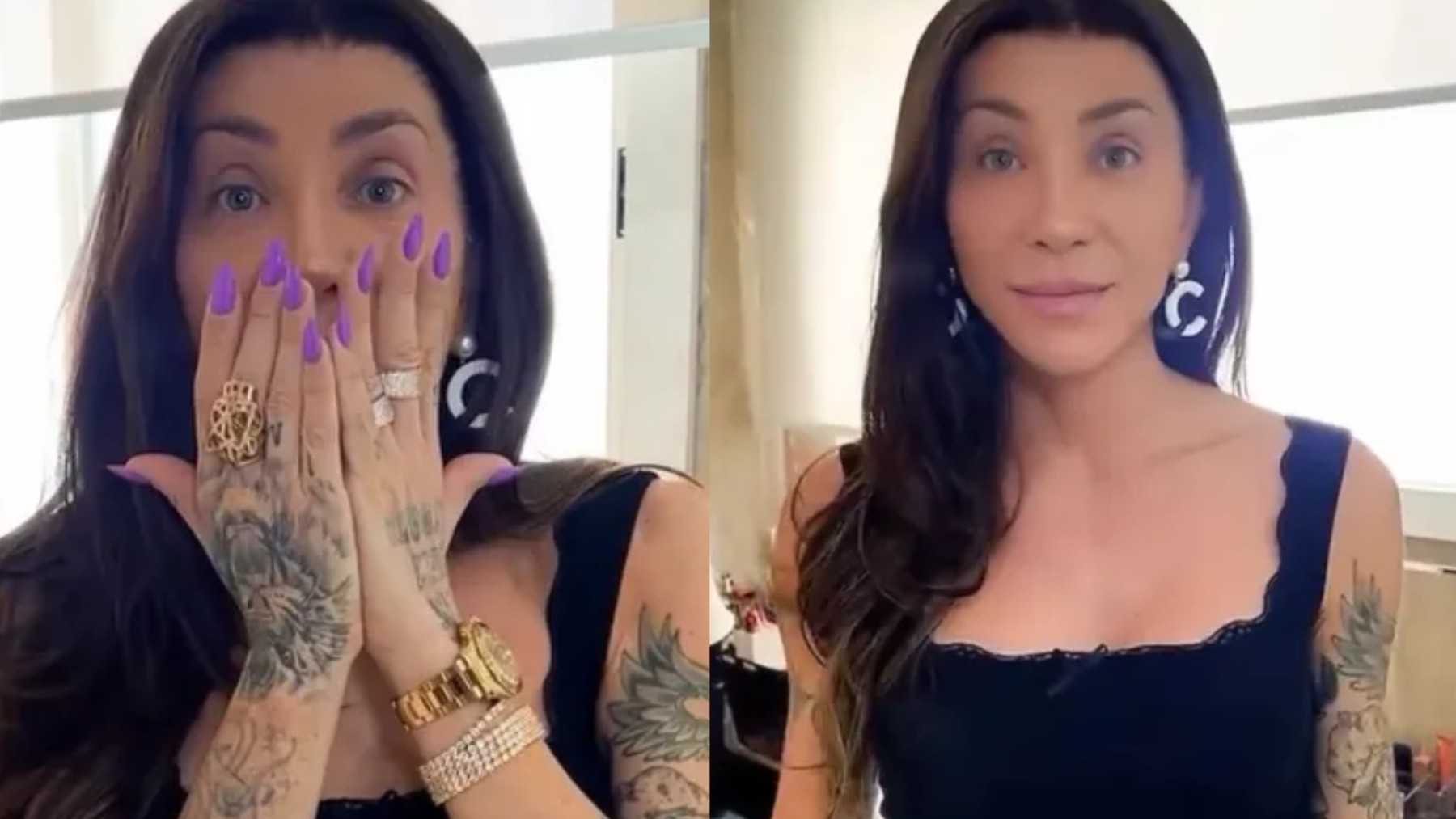 Maya Massafera mostra resultado de cirurgia no maxilar e alerta sobre ...