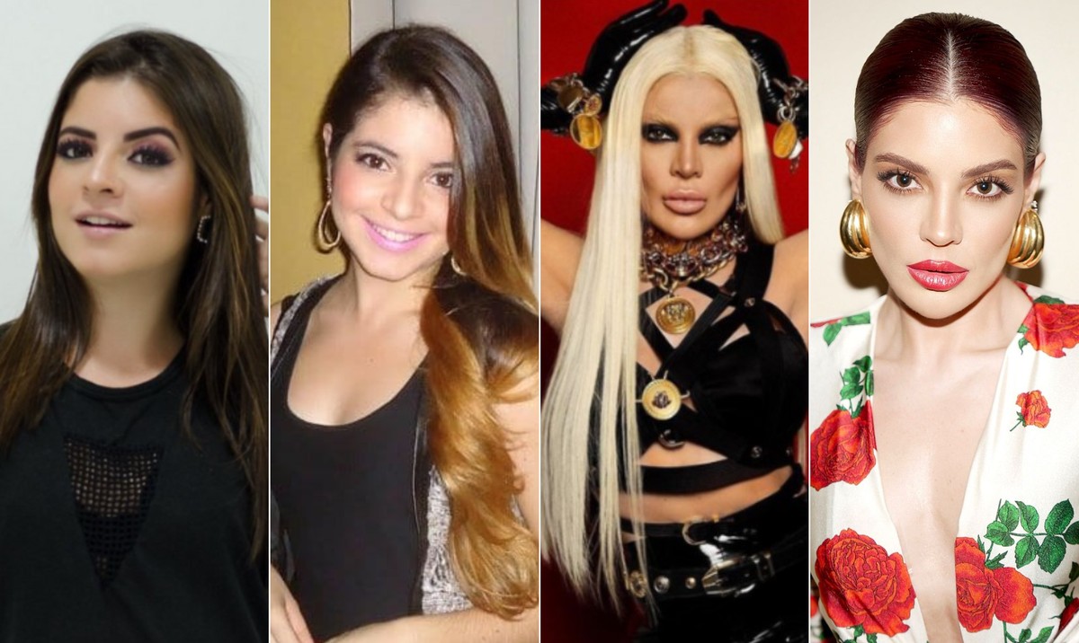 A nova Gkay: harmonização facial, fios 'cherry' e corpo bem mais magro ...