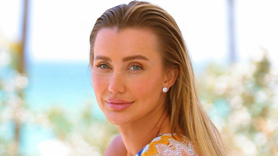 Ana Paula Siebert recebe 'conselho' sobre uso de botox na boca e ...