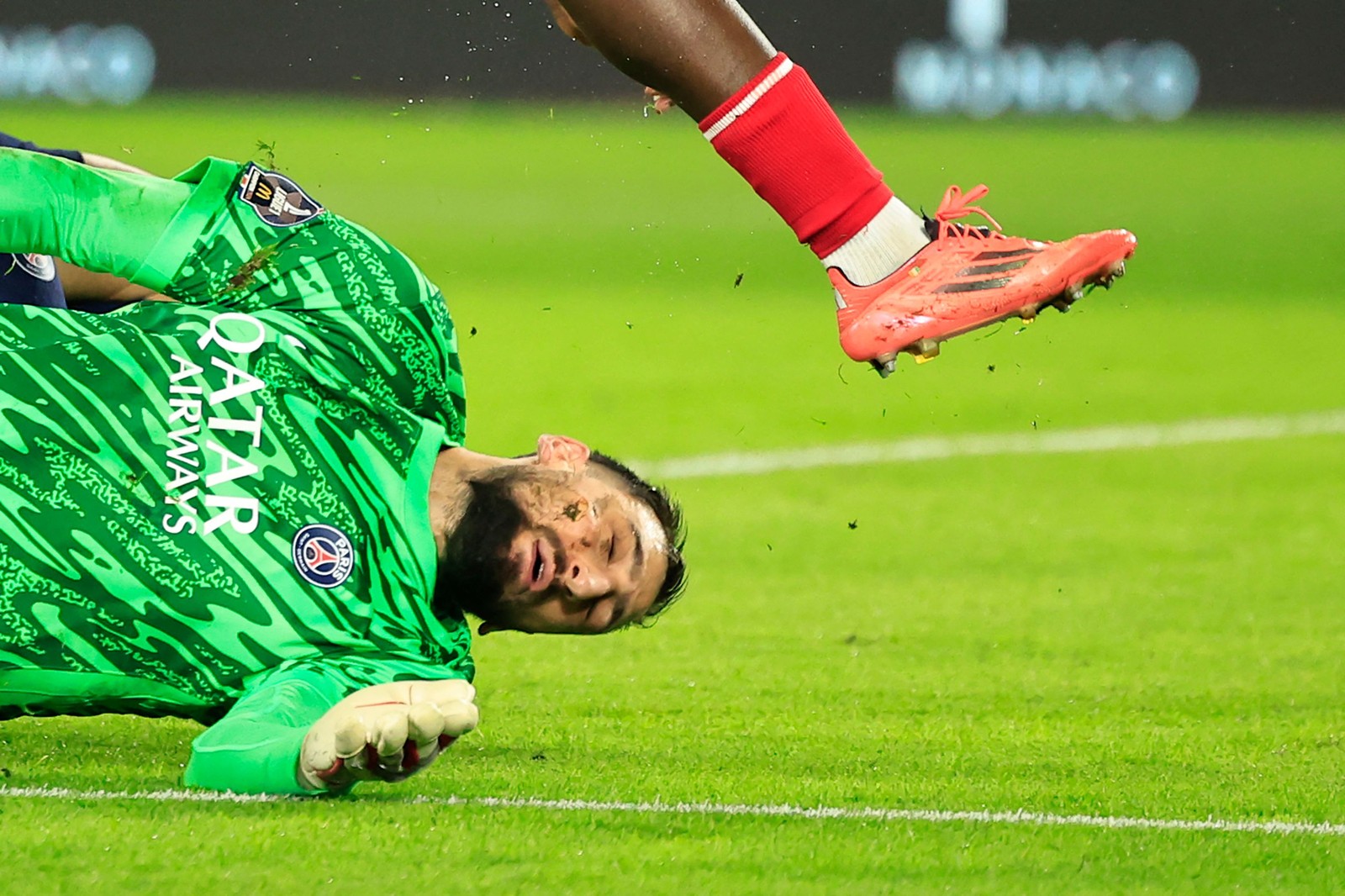 'Trauma facial': PSG divulga diagnóstico de Donnarumma após pisão no ...