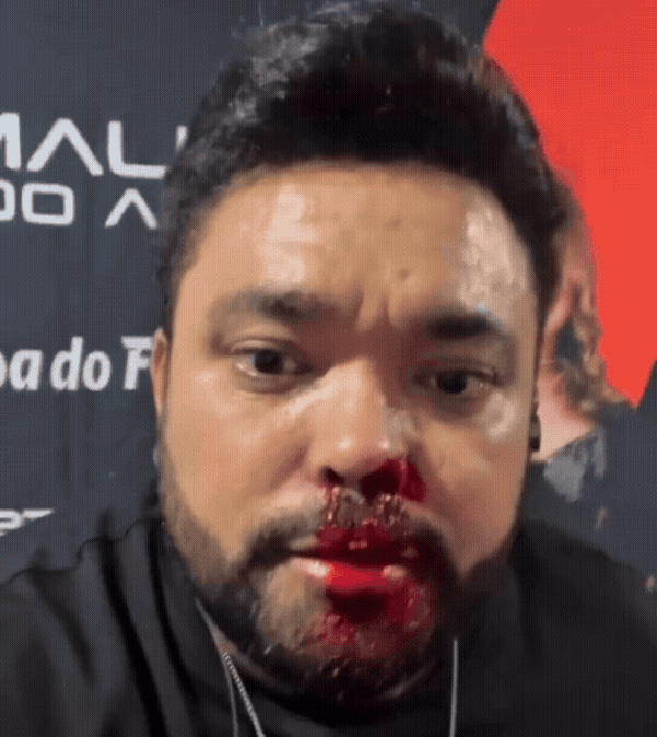 Saiba quem é Rick Rocha, vocalista da Malla 100 Alça atingido por lata ...