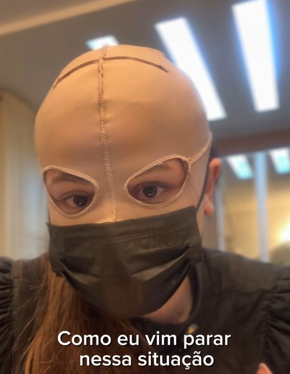 Peeling de ATA com óleo de Cróton: entenda o que é o procedimento ...