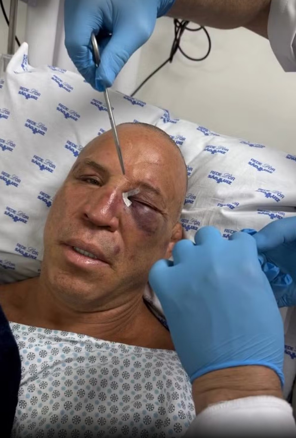 Tudo o que se sabe sobre a briga generalizada após a luta Wanderlei ...