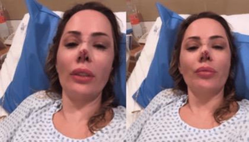 Influenciadora brasileira segue com sequelas após mordida do cachorro no México: 'Achei que ...