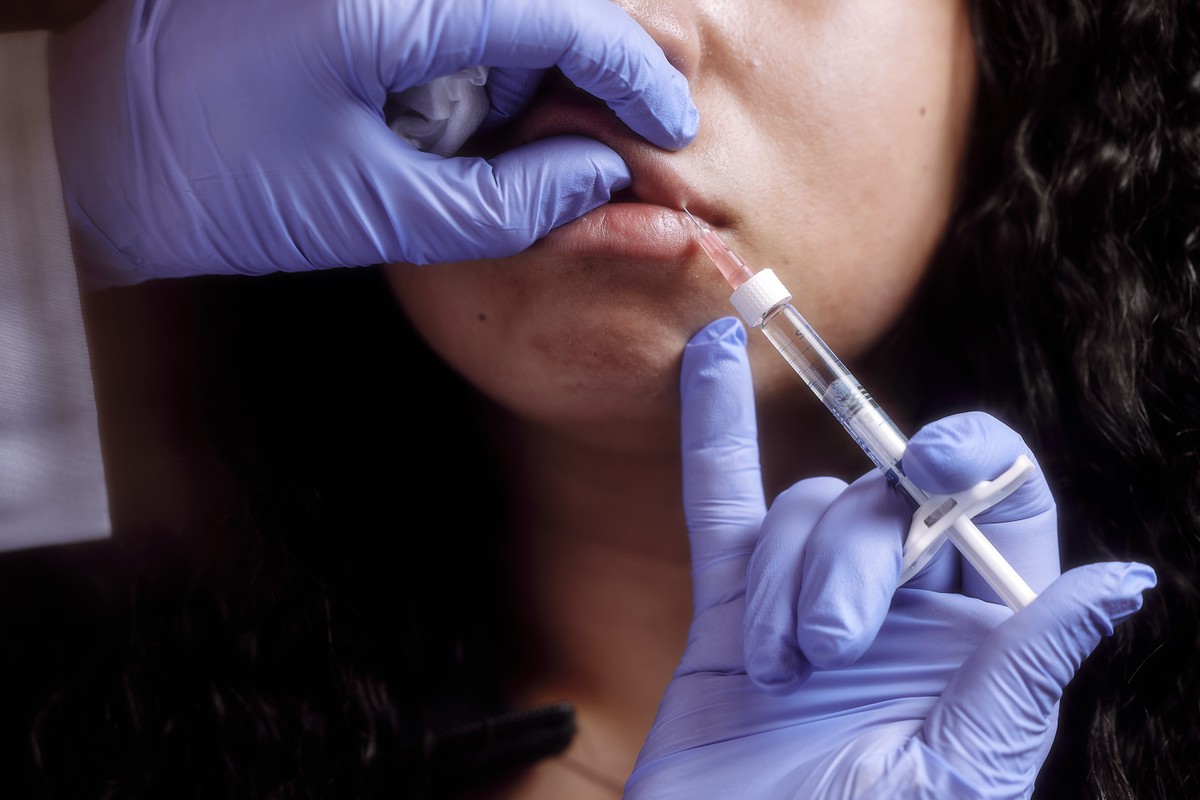 Pensa em fazer preenchimento labial? Veja as 4 coisas que você precisa ...