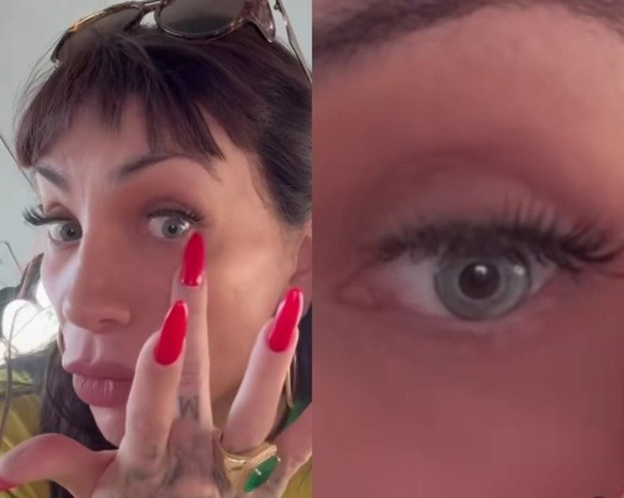 Maya Massafera: os riscos do procedimento para mudar a cor dos olhos ...