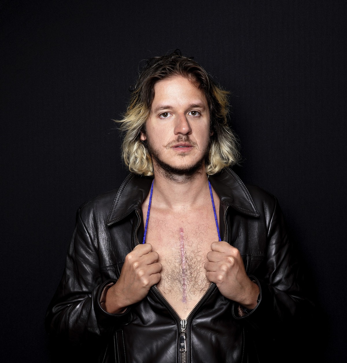 Rubel fala de mudança na vida e na música após cirurgia no coração ...