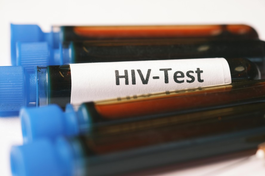 HIV: 95% das pessoas em tratamento no Brasil não transmitem o vírus ...