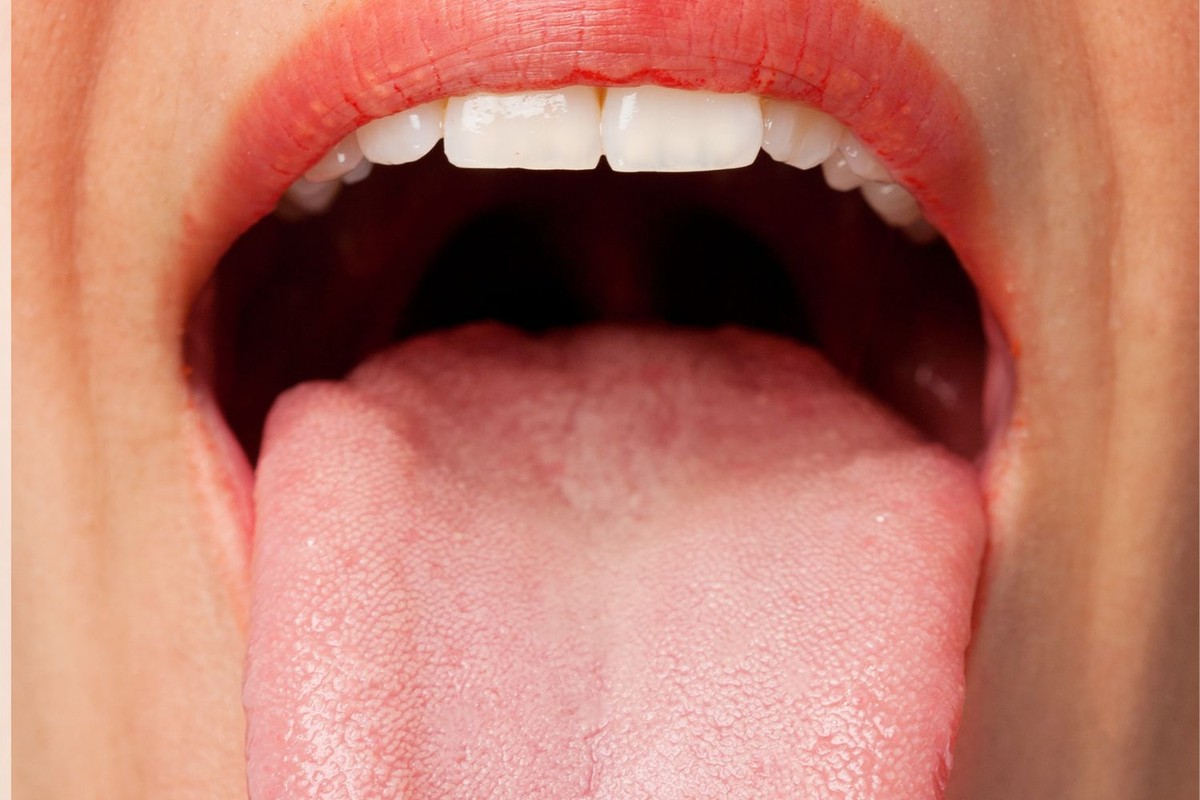 A nova moda agora é colocar piercing na úvula; entenda os riscos da prática