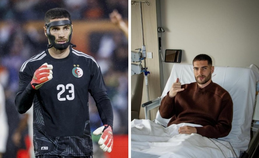 Mascarado: Filho de Zidane teve fratura no rosto, viveu dilema sobre ...