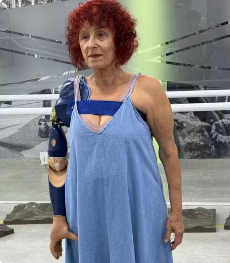 Escritora Roseana Murray usa prótese após perder braço em ataque de ...