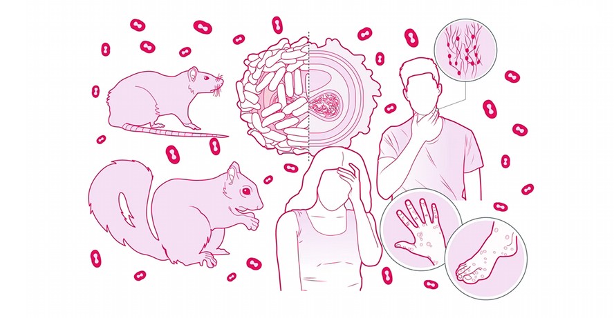 Mpox: conheça sintomas, transmissão, prevenção e tudo o que se sabe ...