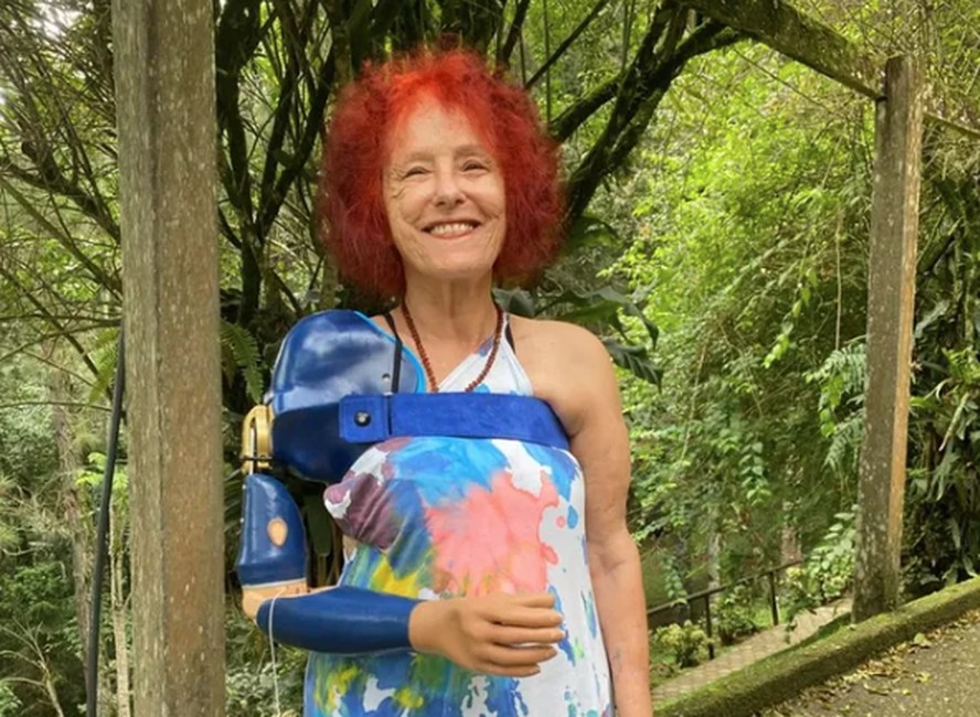 Escritora Roseana Murray usa prótese biônica e comemora: 'Consegui ...