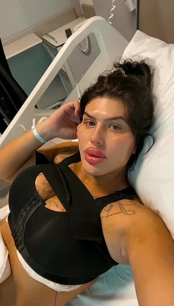 Obcecada por cirurgias estéticas, modelo relata sufoco após gastar R$ 62 mil com plástica nos ...