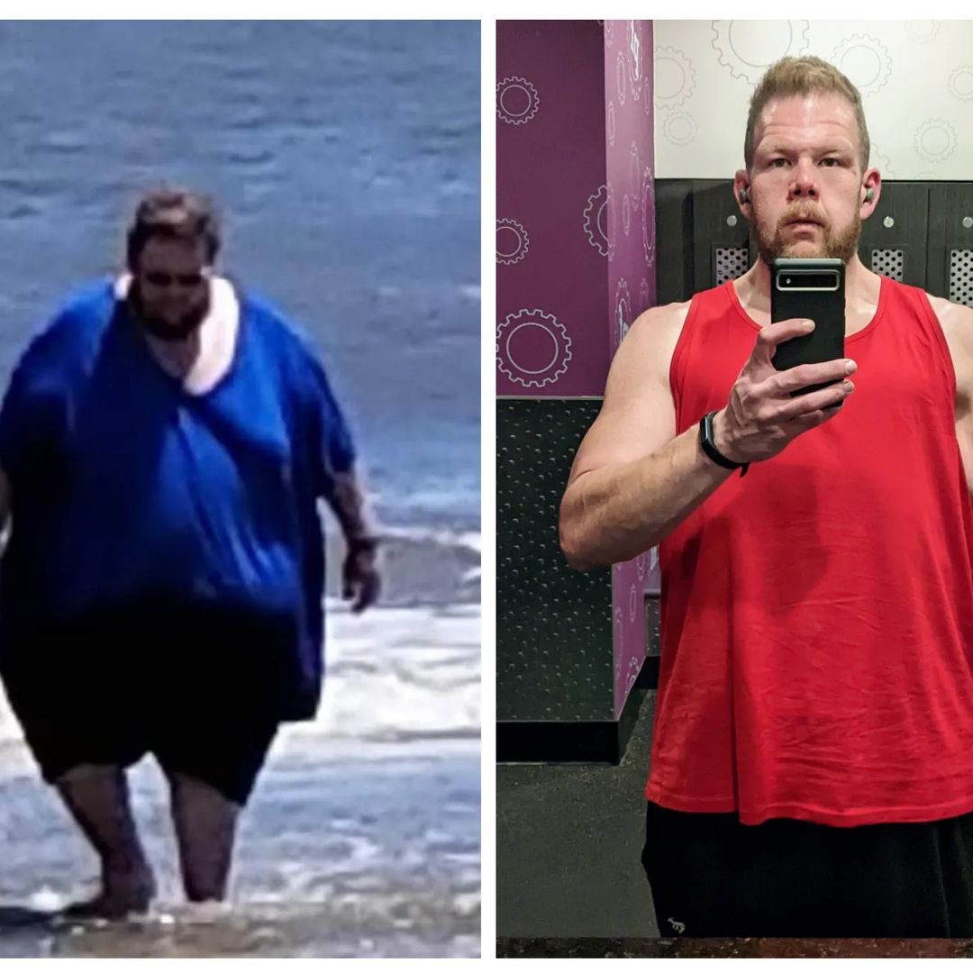 Homem perde 163 kg e luta contra excesso de pele: veja transformação em ...