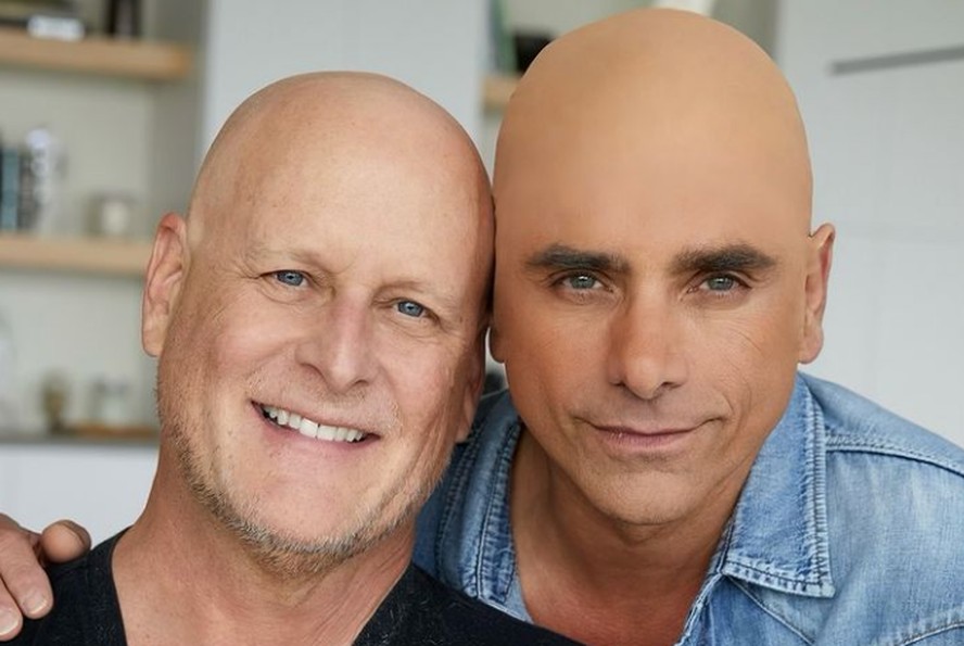 John Stamos é criticado por usar 'falsa careca' para apoiar o colega Dave Coulier, que faz ...