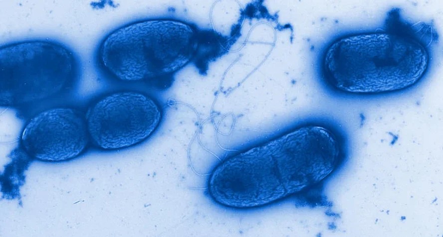 Pseudomonas aeruginosa: o que é a bactéria identificada em lote da água ...