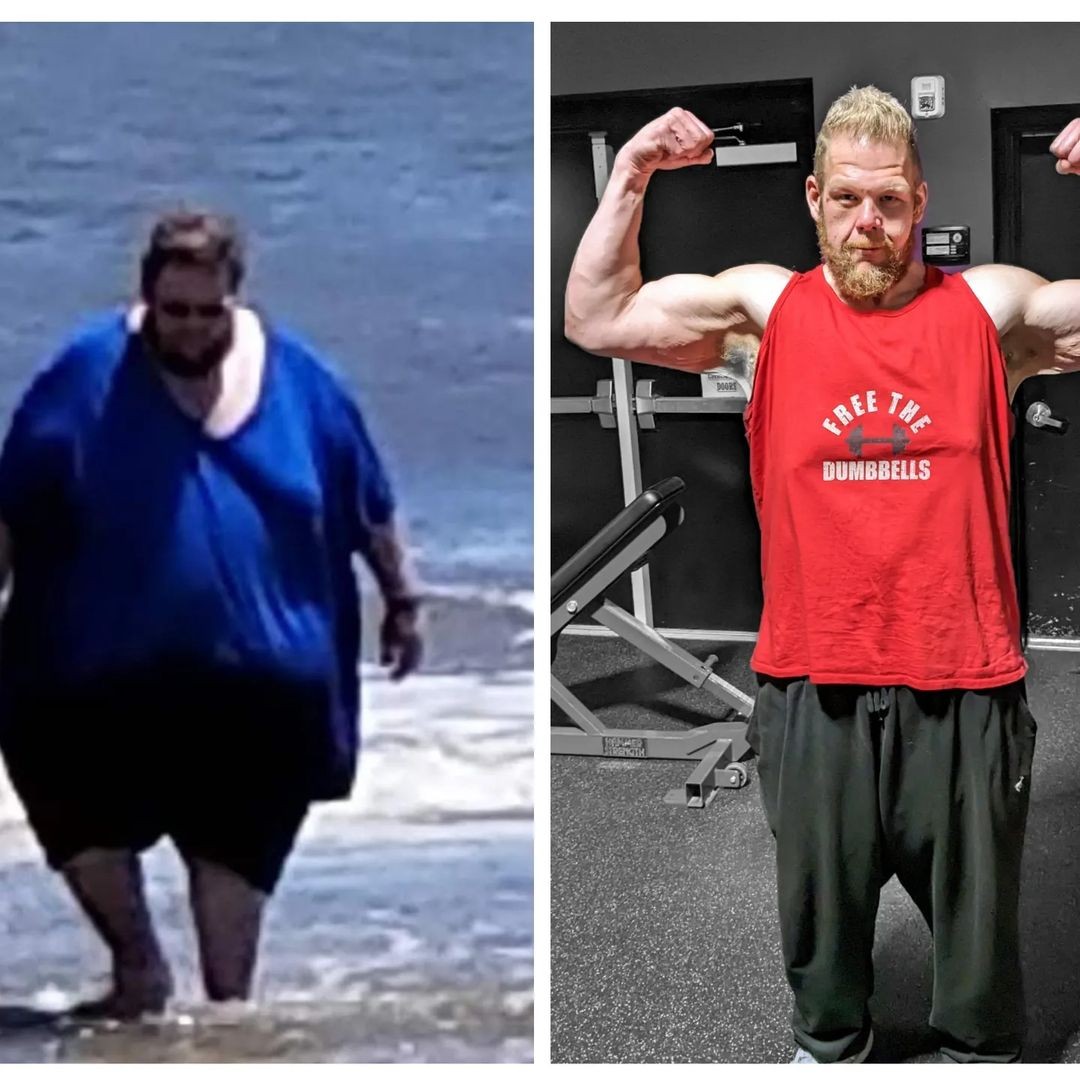 Homem perde 163 kg e luta contra excesso de pele: veja transformação em ...