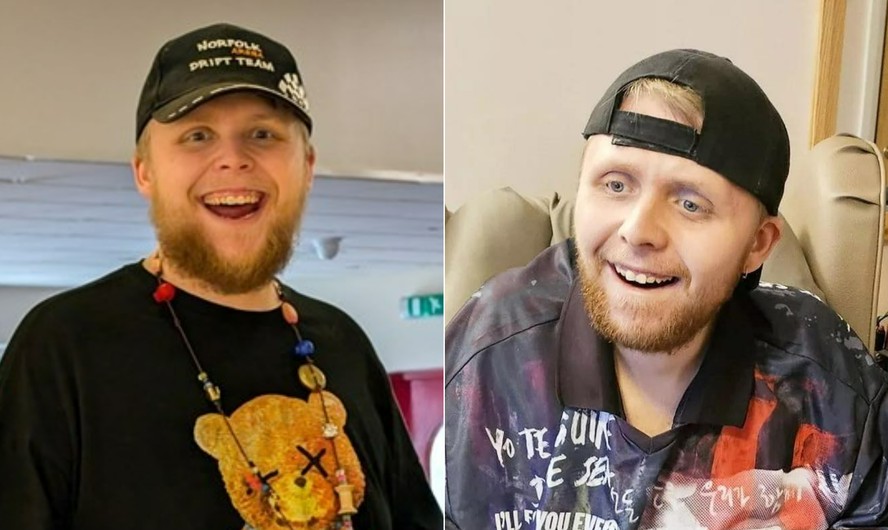 Aos 24 anos, homem com demência morre apenas dois anos após o diagnóstico