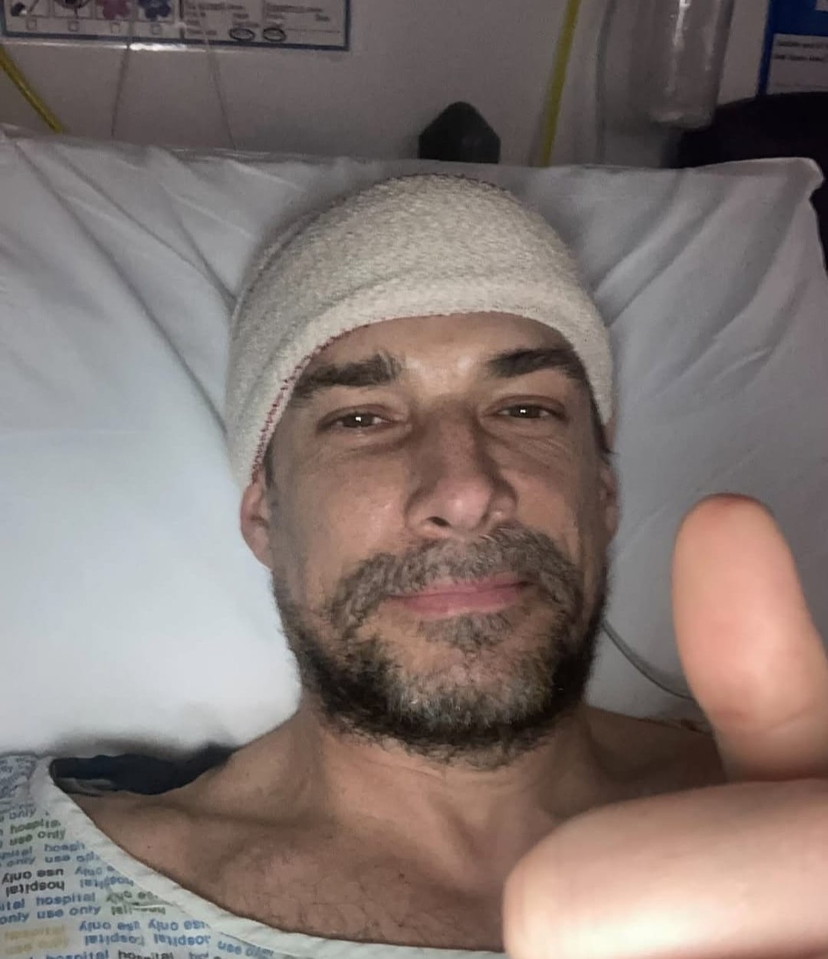 O ator Craig Russell foi diagnosticado com tumor cerebral após sentir ...