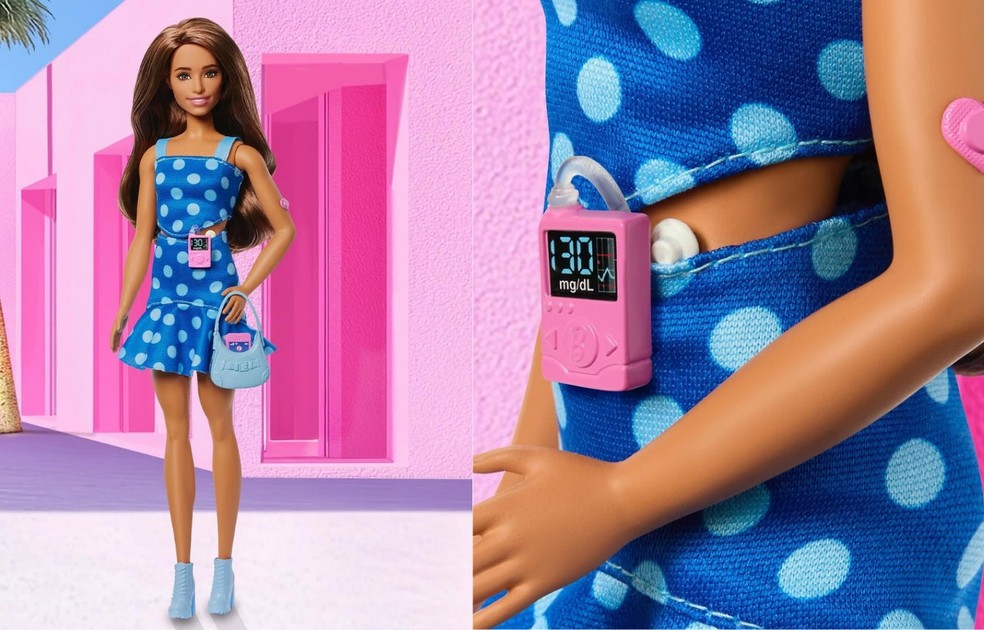 Primeira Barbie com diabetes tipo 1 é lançada; boneca usa bomba de ...