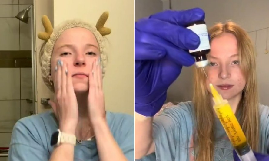 Rotina de americana que precisa se alimentar por sonda após contrair ...