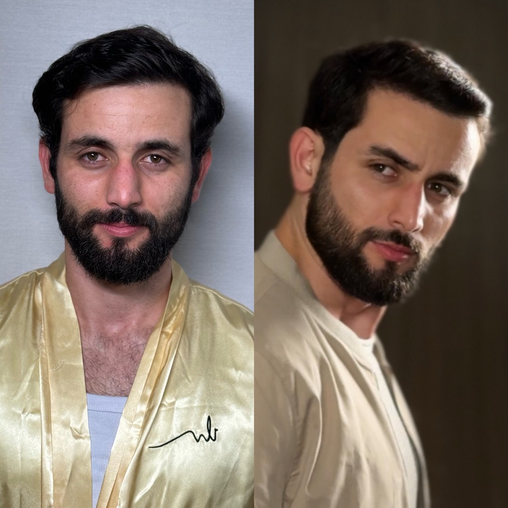 Isabelle e Matteus passam por transformação após final do 'BBB 24 ...