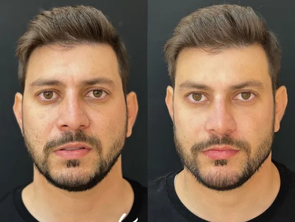 Ex-'BBB' Caio Afiune diz que sofreu preconceito por ter feito ...