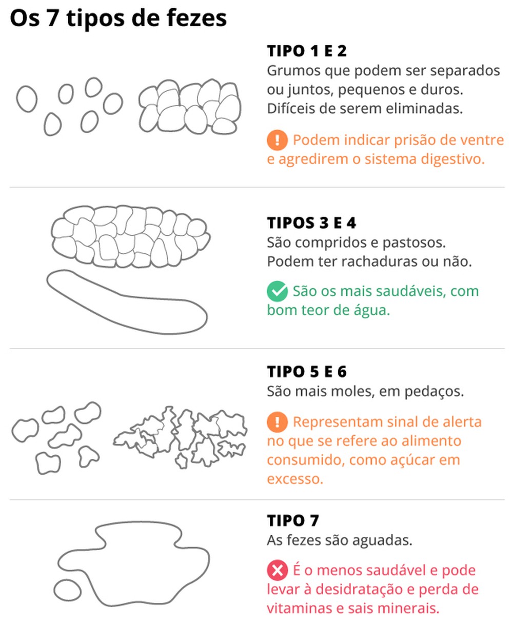 Prisão de ventre, sangue e fezes achatadas: como Preta Gil descobriu o ...