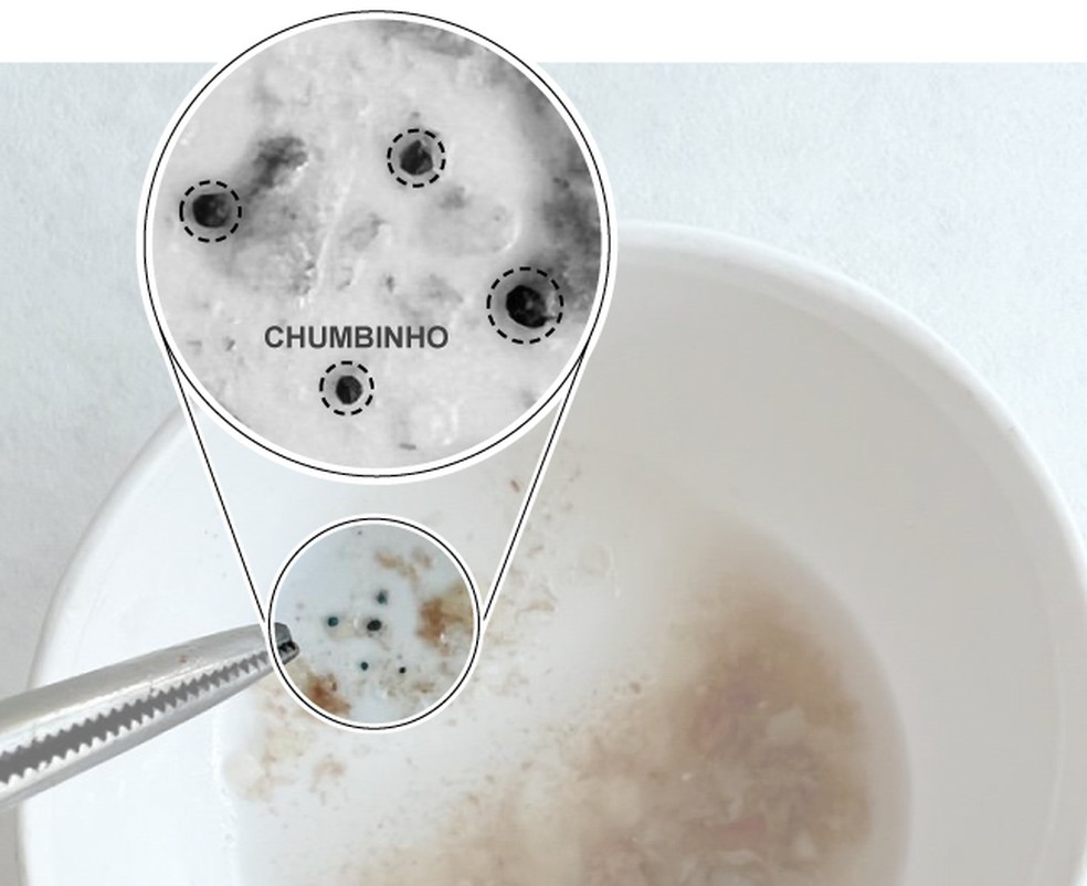 Perícia detecta pedrinhas em estômago de enteado e sugere chumbinho ...