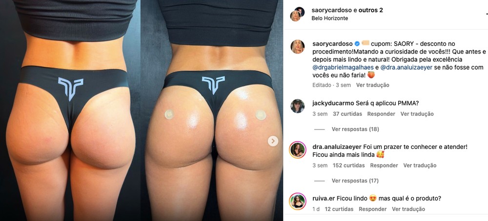 Quem é Saory Cardoso, ex-namorada de Marcello Novaes, com quem ator terminou após procedimento ...