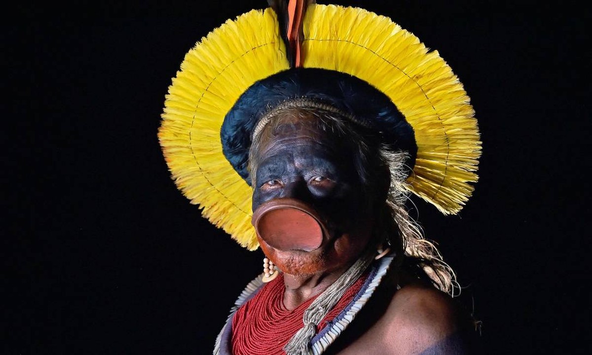 Cacique Raoni faz cirurgia cardíaca e usará marcapasso