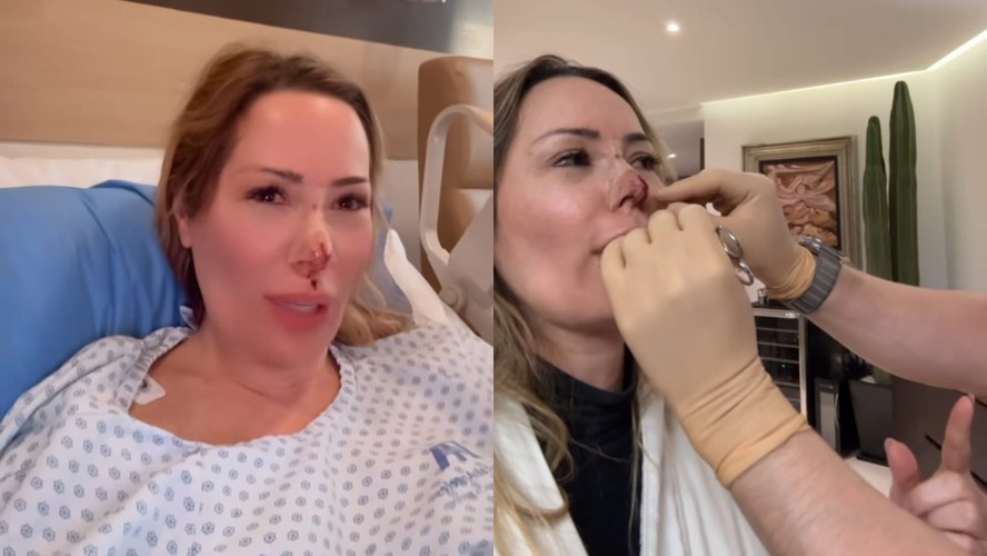 Influenciadora brasileira atacada por cachorro no México faz cirurgia ...