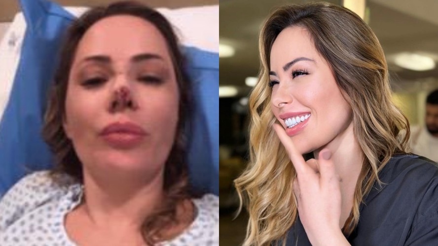 Influenciadora brasileira segue com sequelas após mordida do cachorro no México: 'Achei que ...