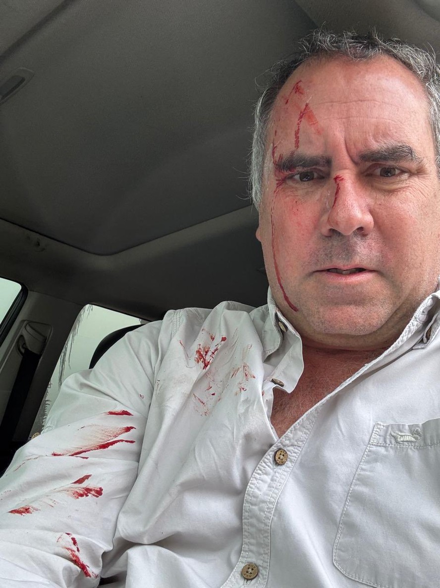 Pré-candidato à presidência é alvo de ataque a tiros no Peru