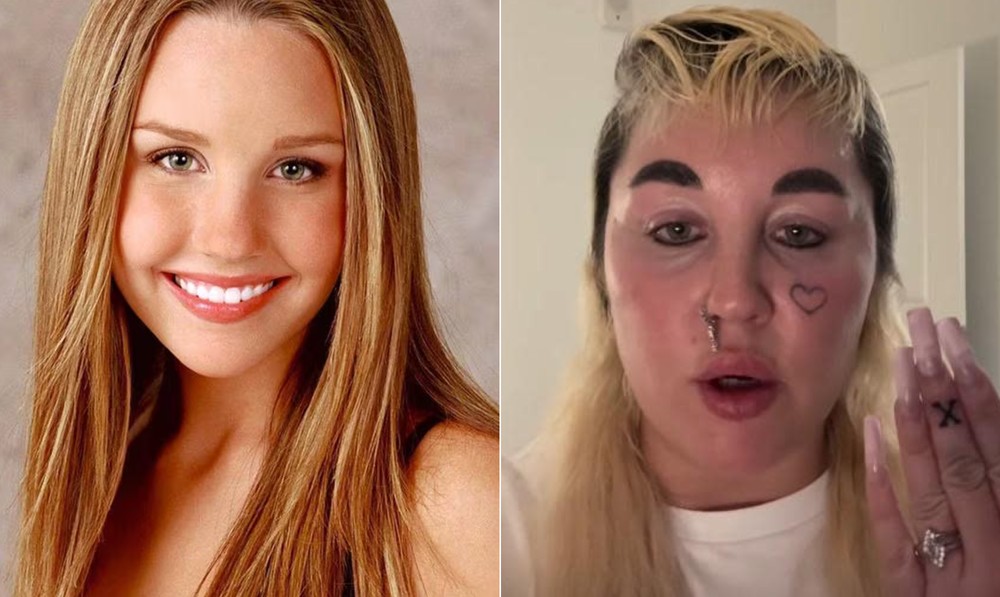 Estrela teen dos anos 2000, Amanda Bynes mostra resultado de ...