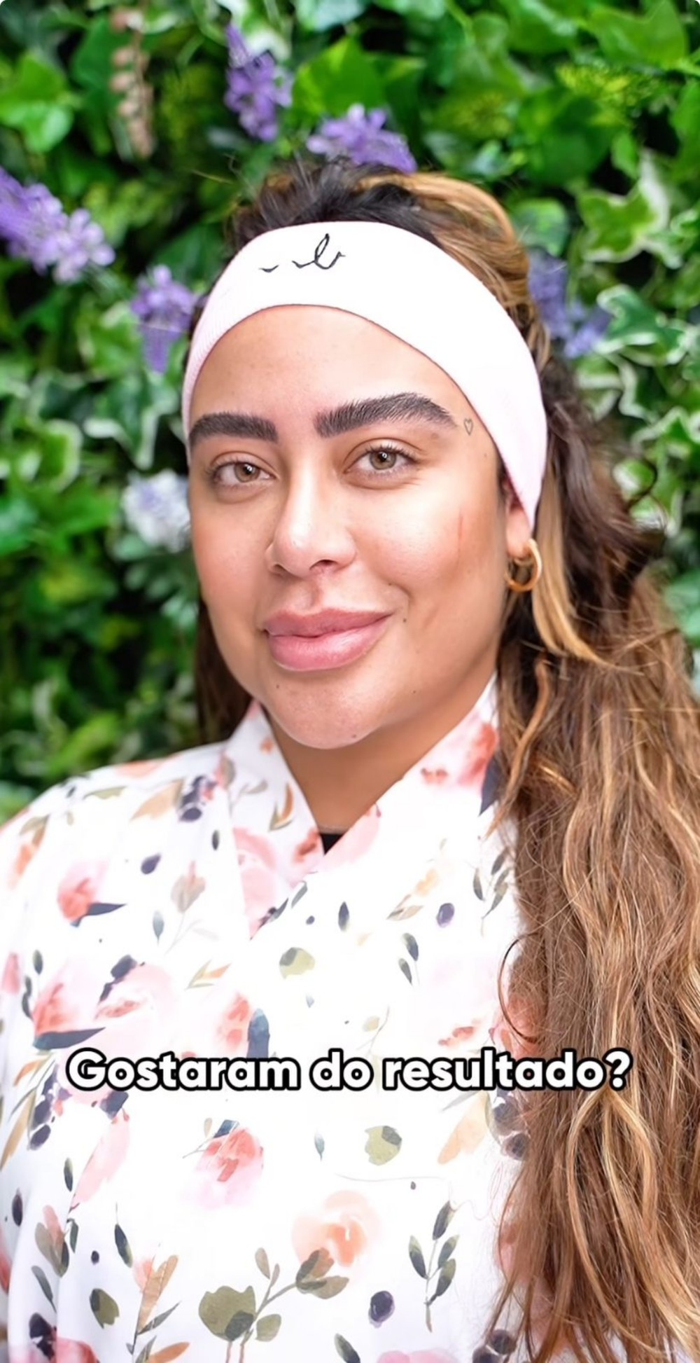 Mudança no rosto de Rafaella Santos viraliza e visual divide opiniões ...
