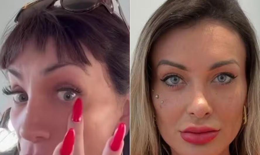 Médicos alertam sobre riscos de cirurgia para mudar cor dos olhos ...