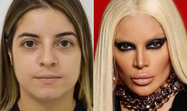 De Eliezer e Latino a Gkay, veja o antes e depois de famosos que ...